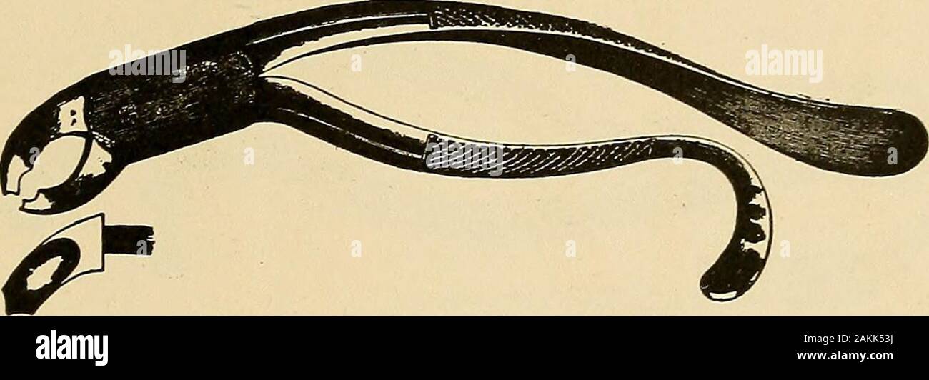 Principles and practice of operative dentistry . Inferior right first ...
