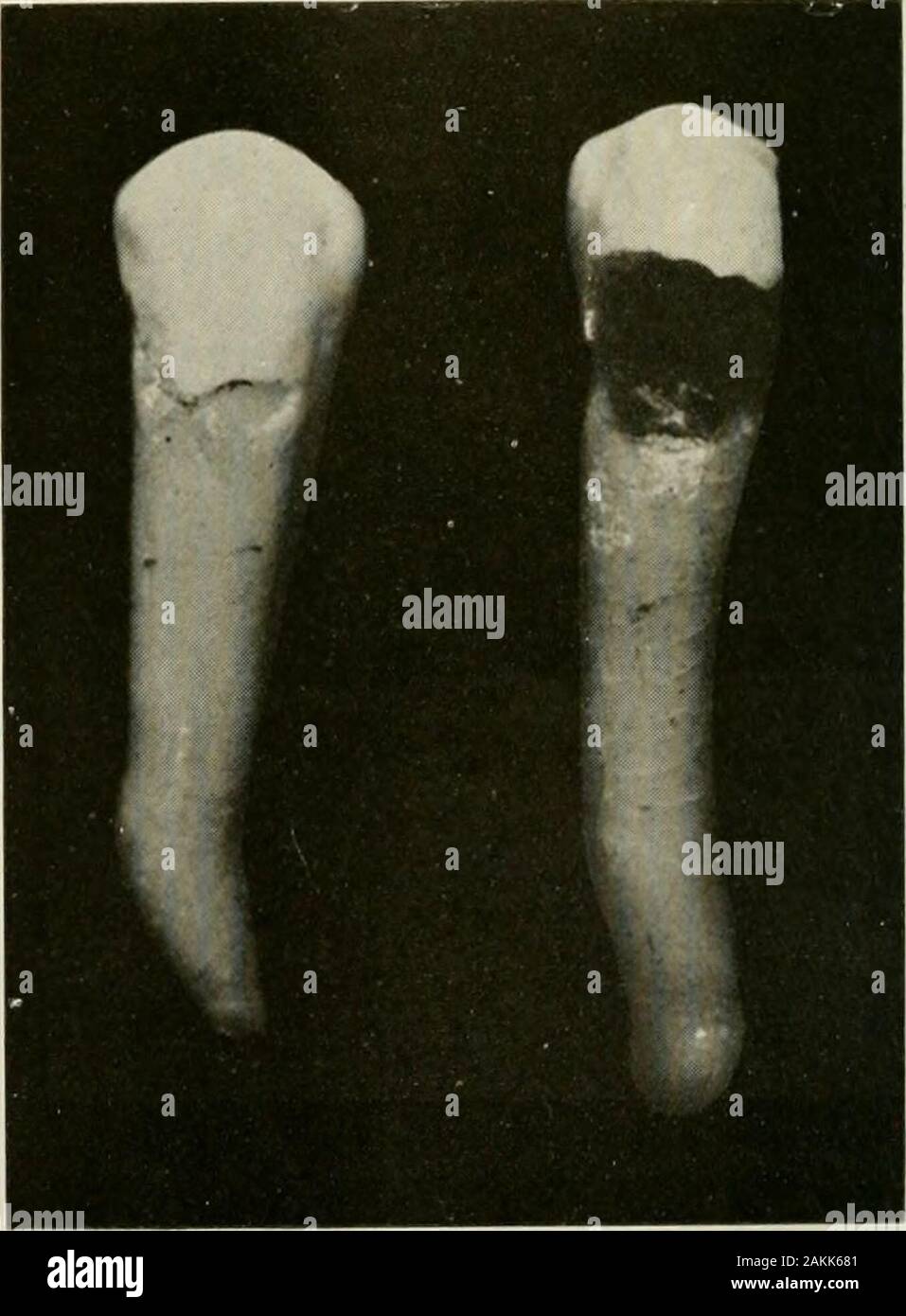 General and dental pathology with special reference to etiology and ...
