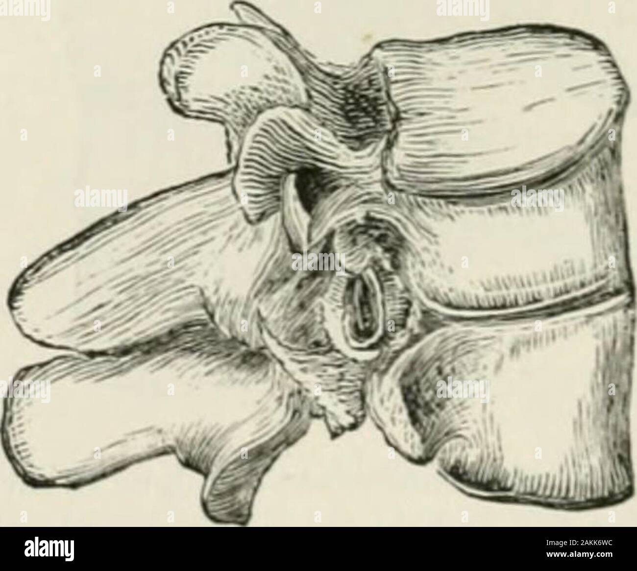 Erector spinae muscles hi-res stock photography and images - Alamy