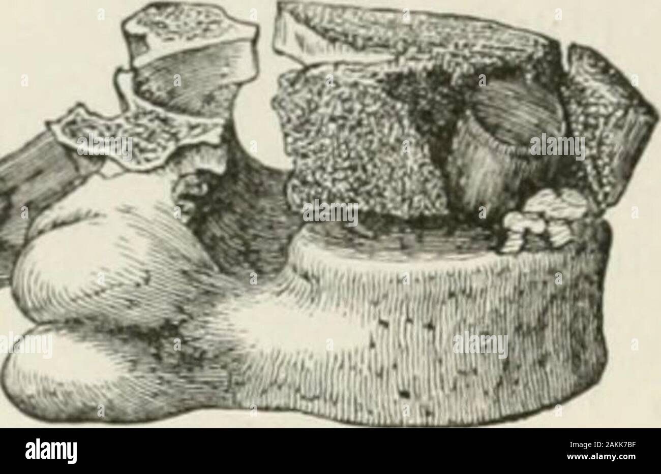 The international encyclopaedia of surgery; a systematic treatise on ...