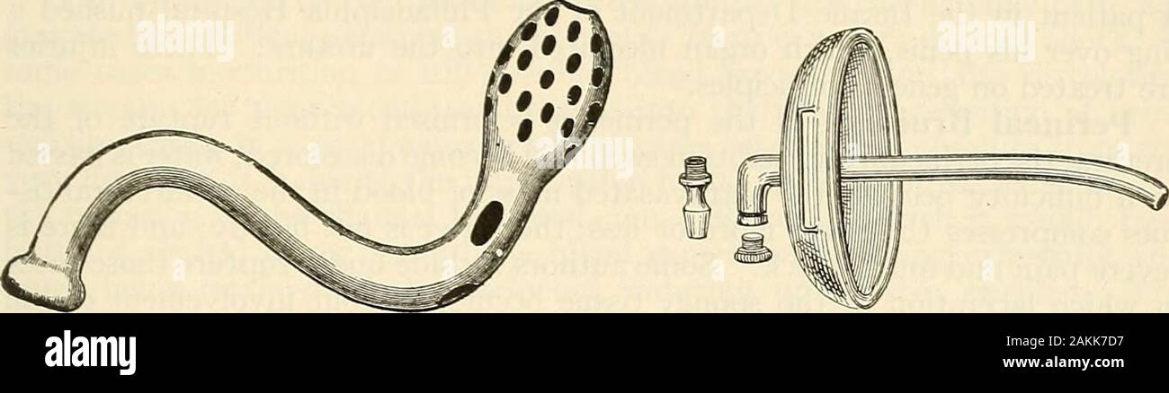 Cystostomy hi-res stock photography and images - Alamy