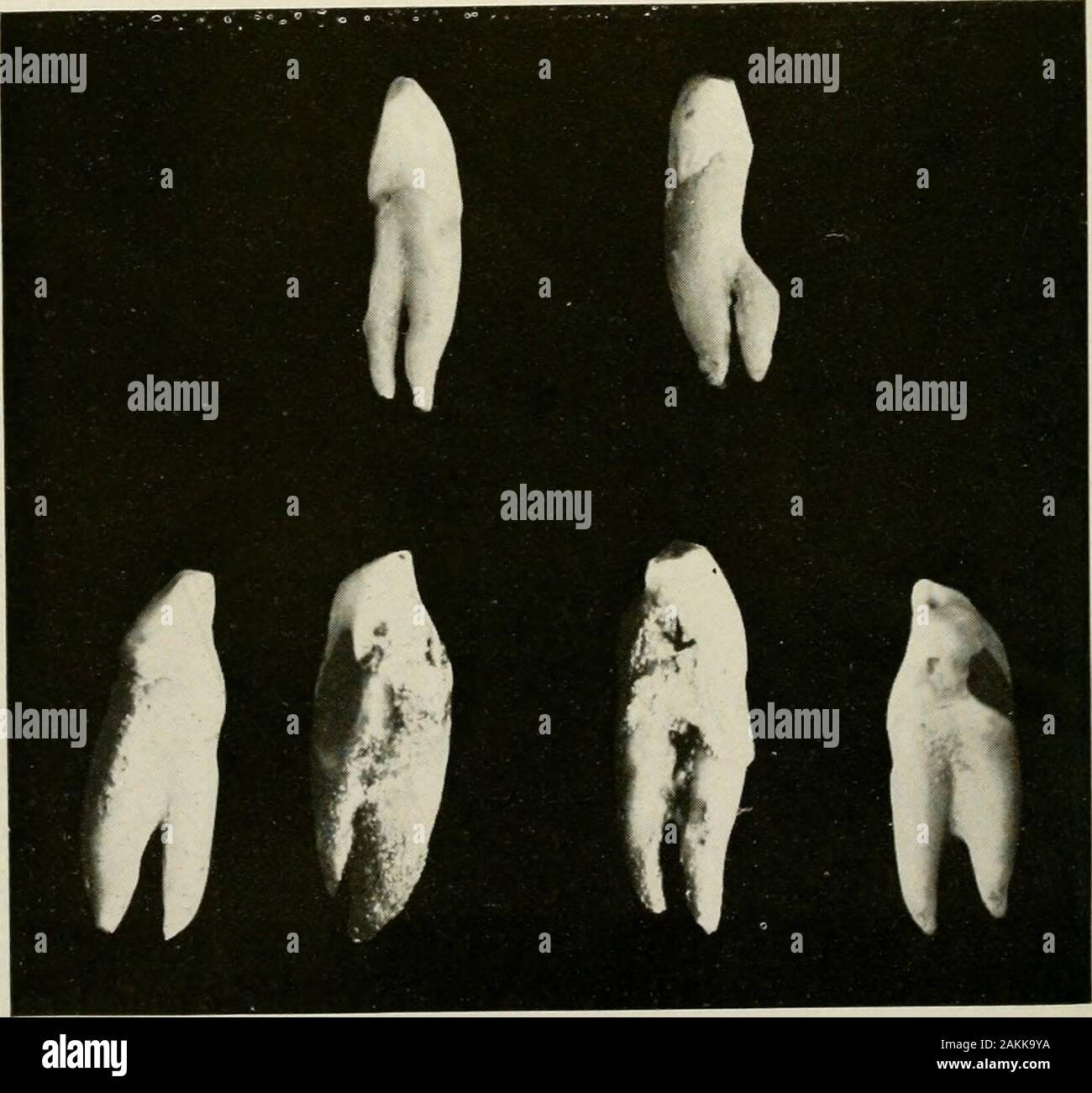 General and dental pathology with special reference to etiology and ...