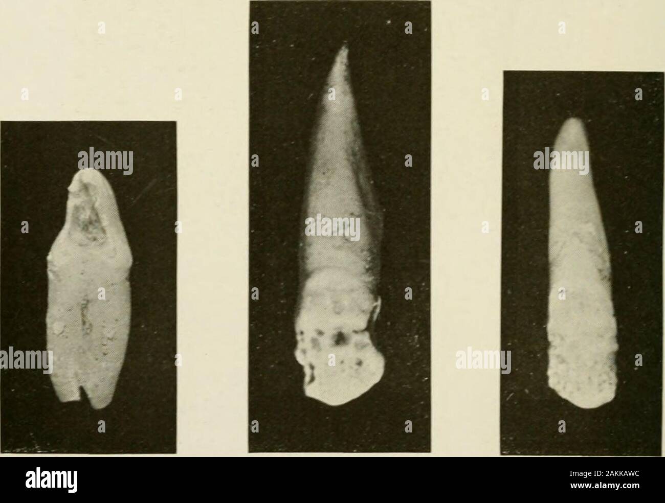 Lower cuspids lower teeth hi-res stock photography and images - Alamy