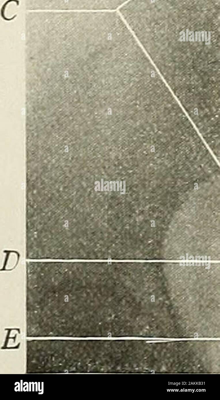 Modern surgery, general and operative Stock Photo - Alamy