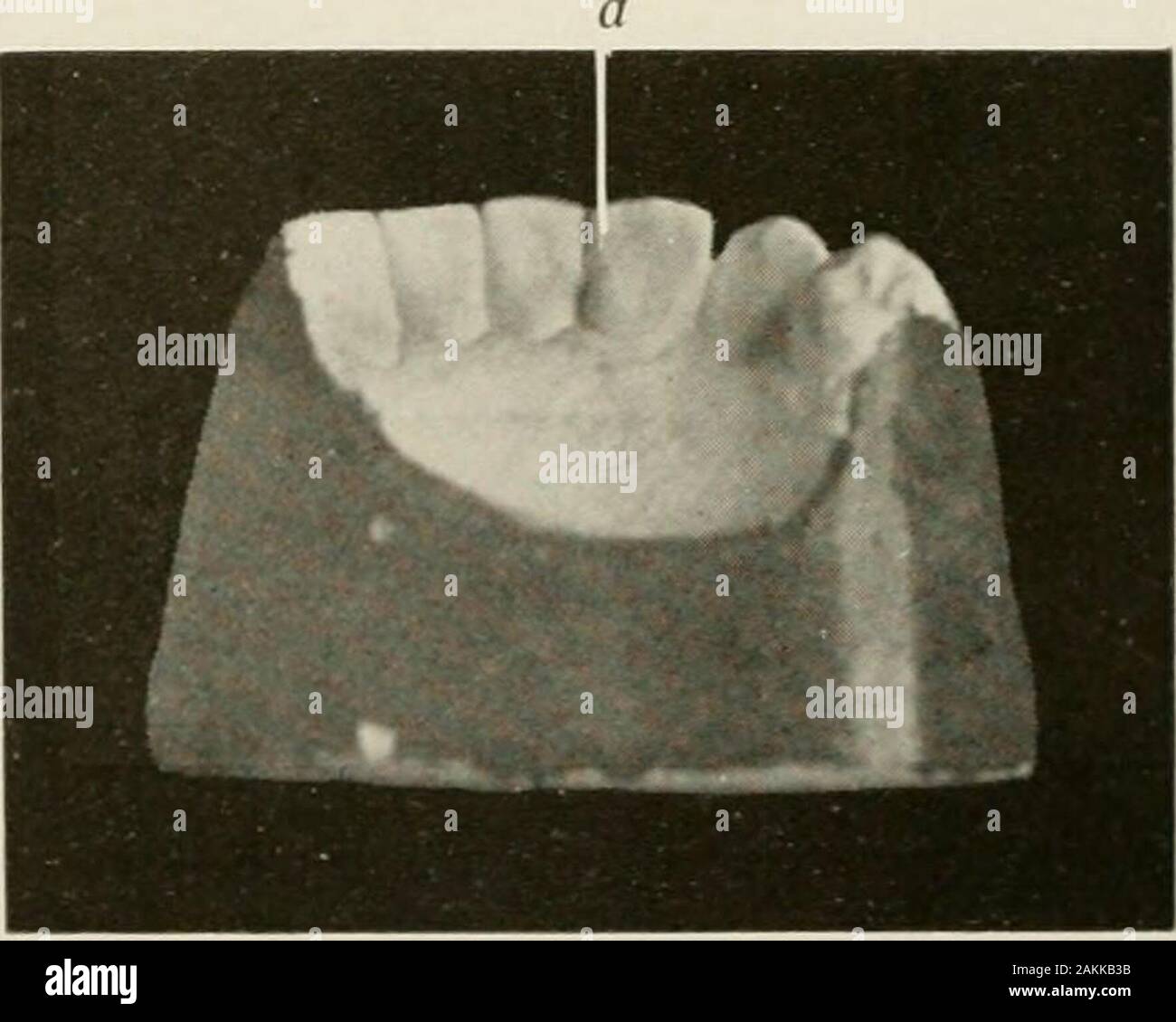 Apical tooth hi-res stock photography and images - Alamy