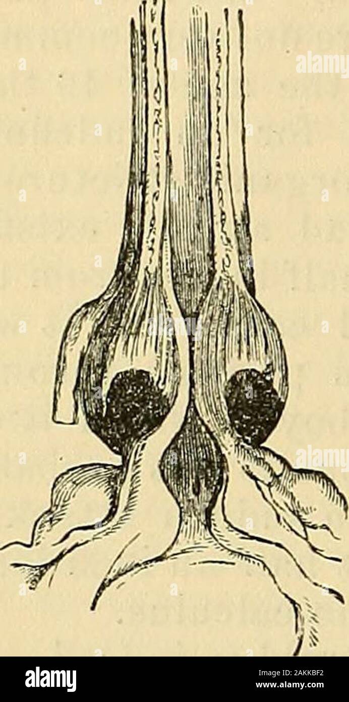 Corpus spongiosum hi-res stock photography and images - Alamy