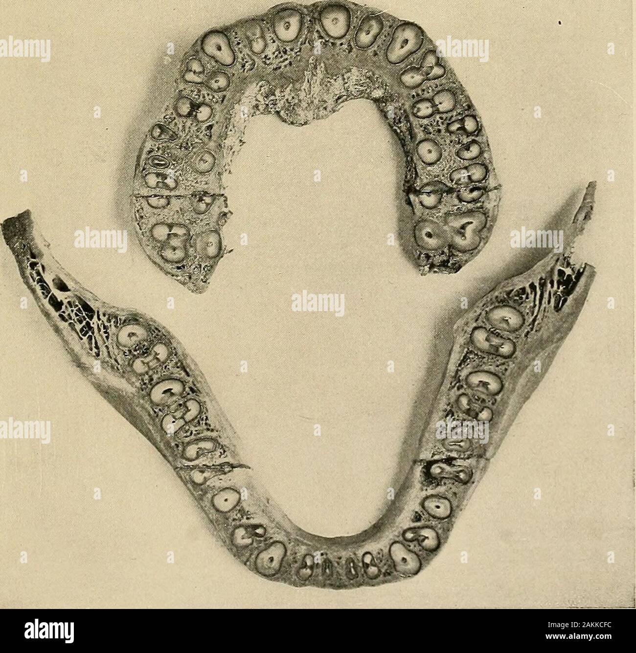 Principles and practice of operative dentistry . Fig. 672.. EXTRACTION ...