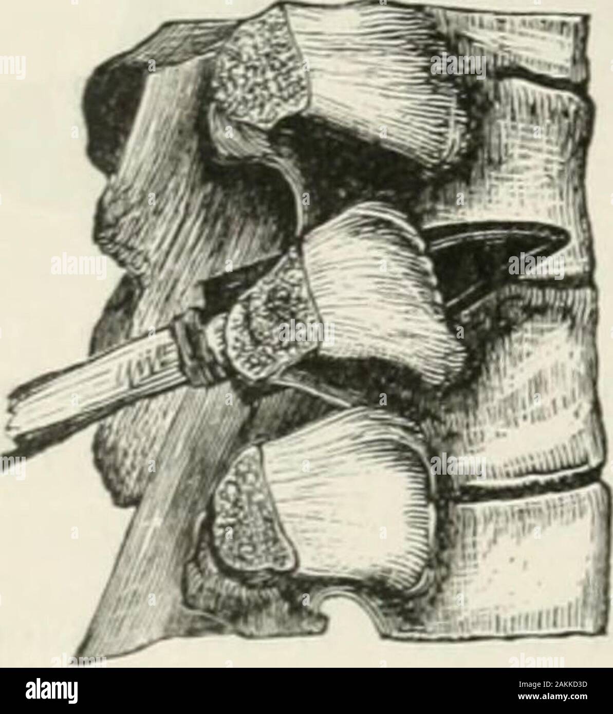 Arrow wound hi-res stock photography and images - Alamy