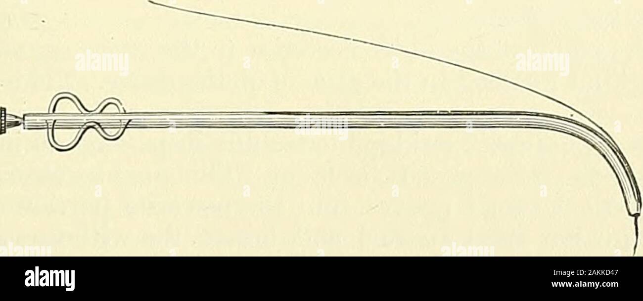 Urethrotomy hi-res stock photography and images - Alamy