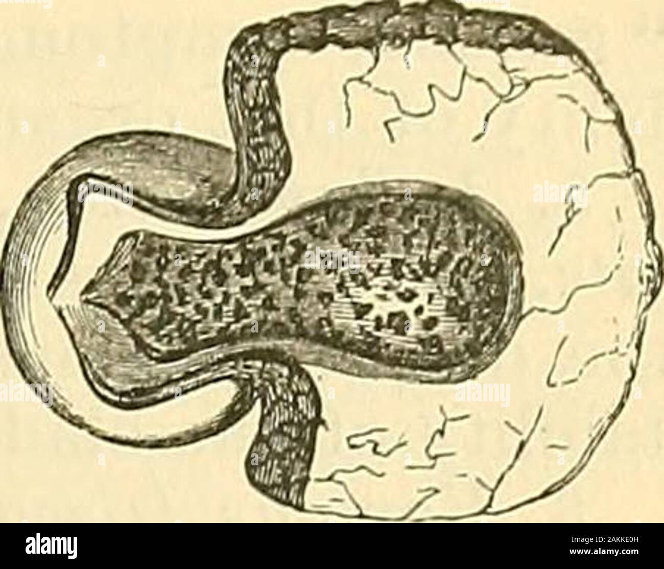 The science and art of surgery : being a treatise on surgical injuries ...