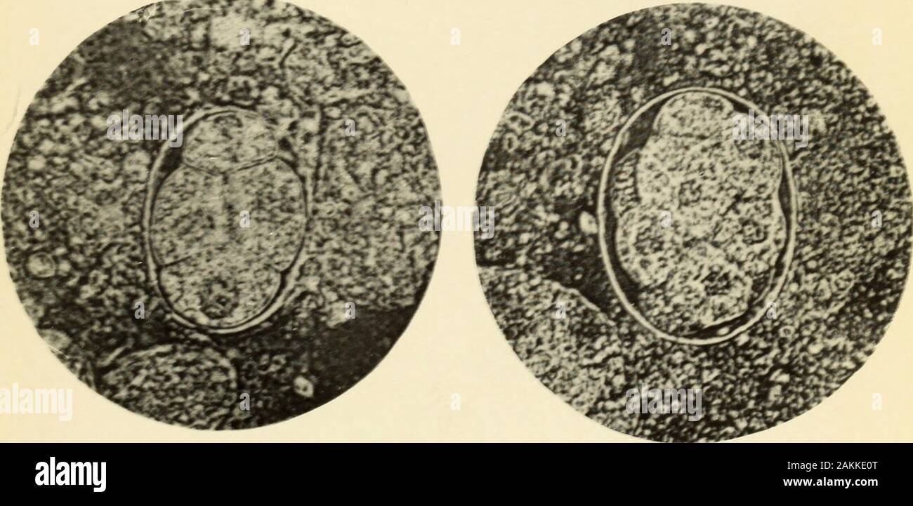 Uncinariasis (Hookworm disease) in Porto Rico : a medical and economic ...