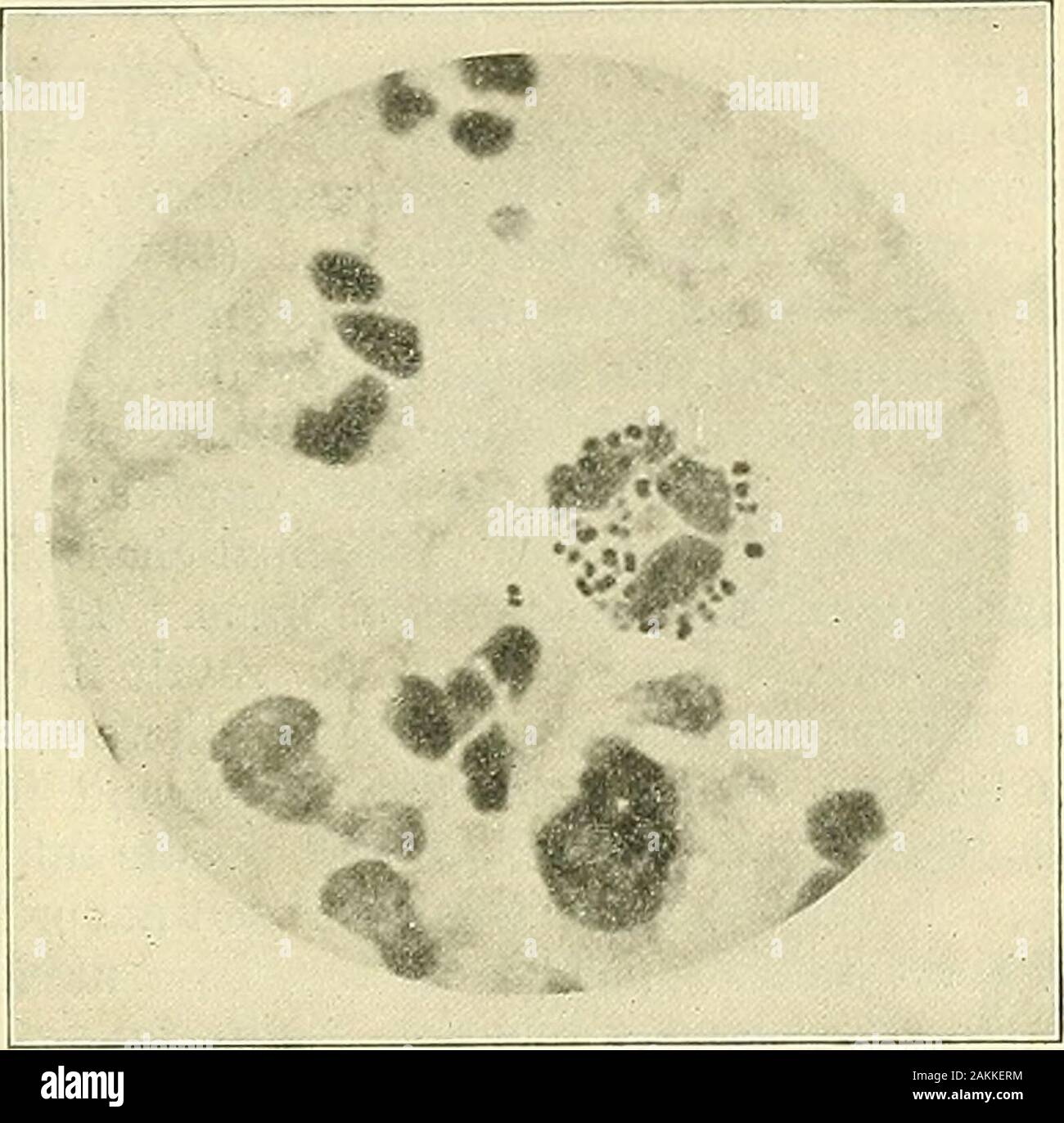 Gonococci hi-res stock photography and images - Alamy