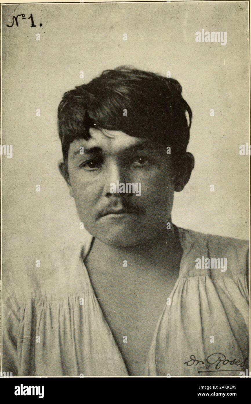 Uncinariasis (Hookworm disease) in Porto Rico : a medical and economic ...