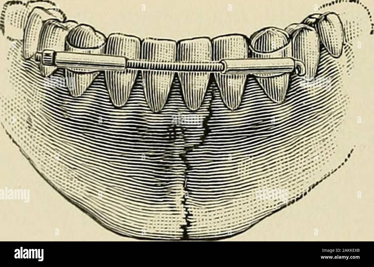 A practical treatise on mechanical dentistry . of very thin ...