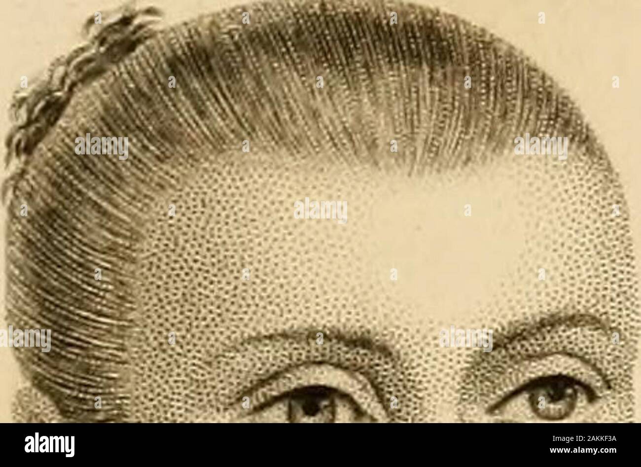 Torticolis muscle hi-res stock photography and images - Alamy