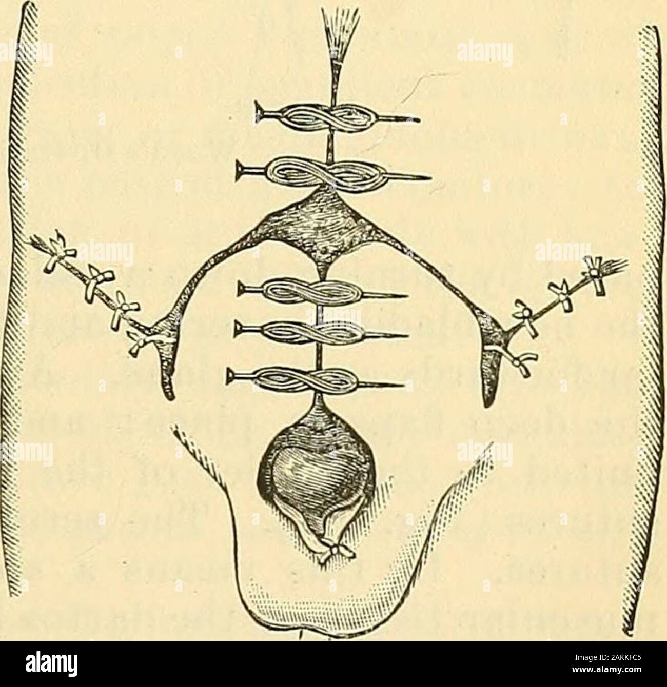 The science and art of surgery : being a treatise on surgical injuries ...