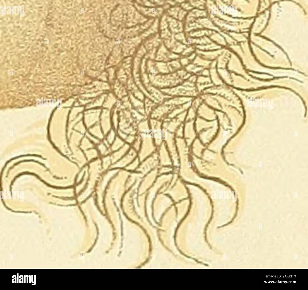 An American text-book of genito-urinary diseases, syphilis and diseases ...