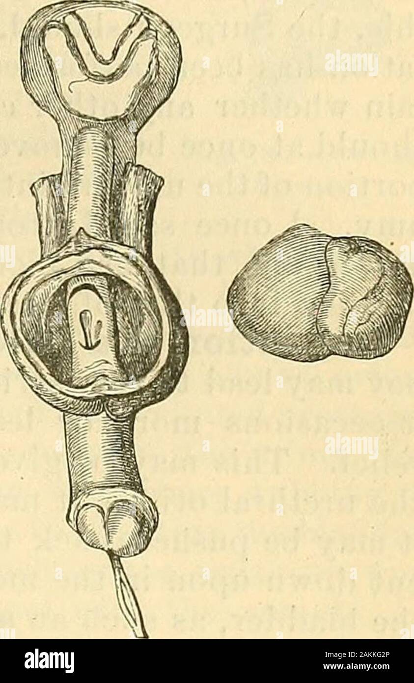 Navicular fossa hi-res stock photography and images - Alamy