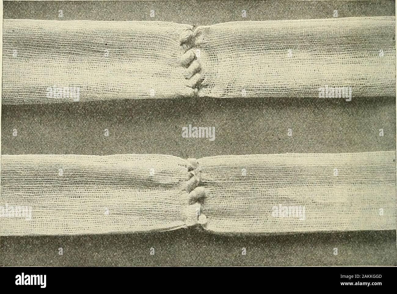 Modern surgery, general and operative . n-mahg-nant troubles. Jepson ...