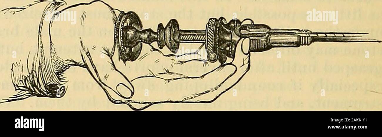 Lithotrite hi-res stock photography and images - Alamy