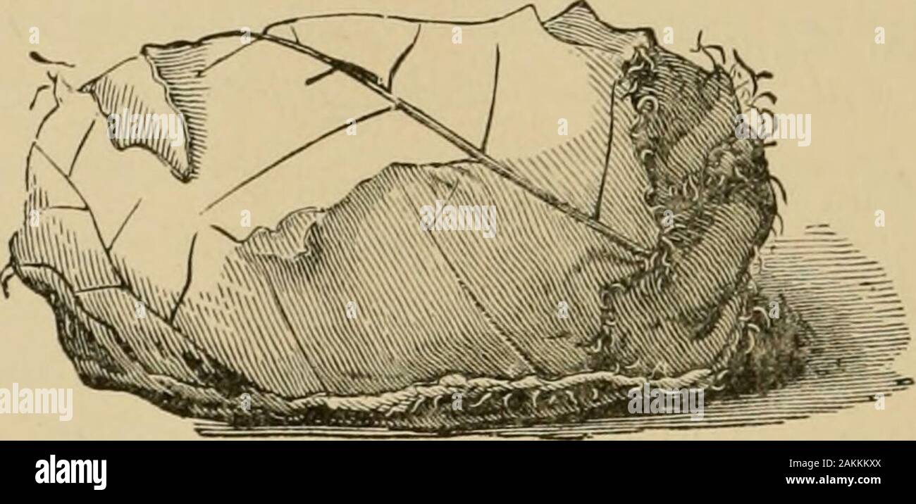 Anterior tubercles hi-res stock photography and images - Alamy