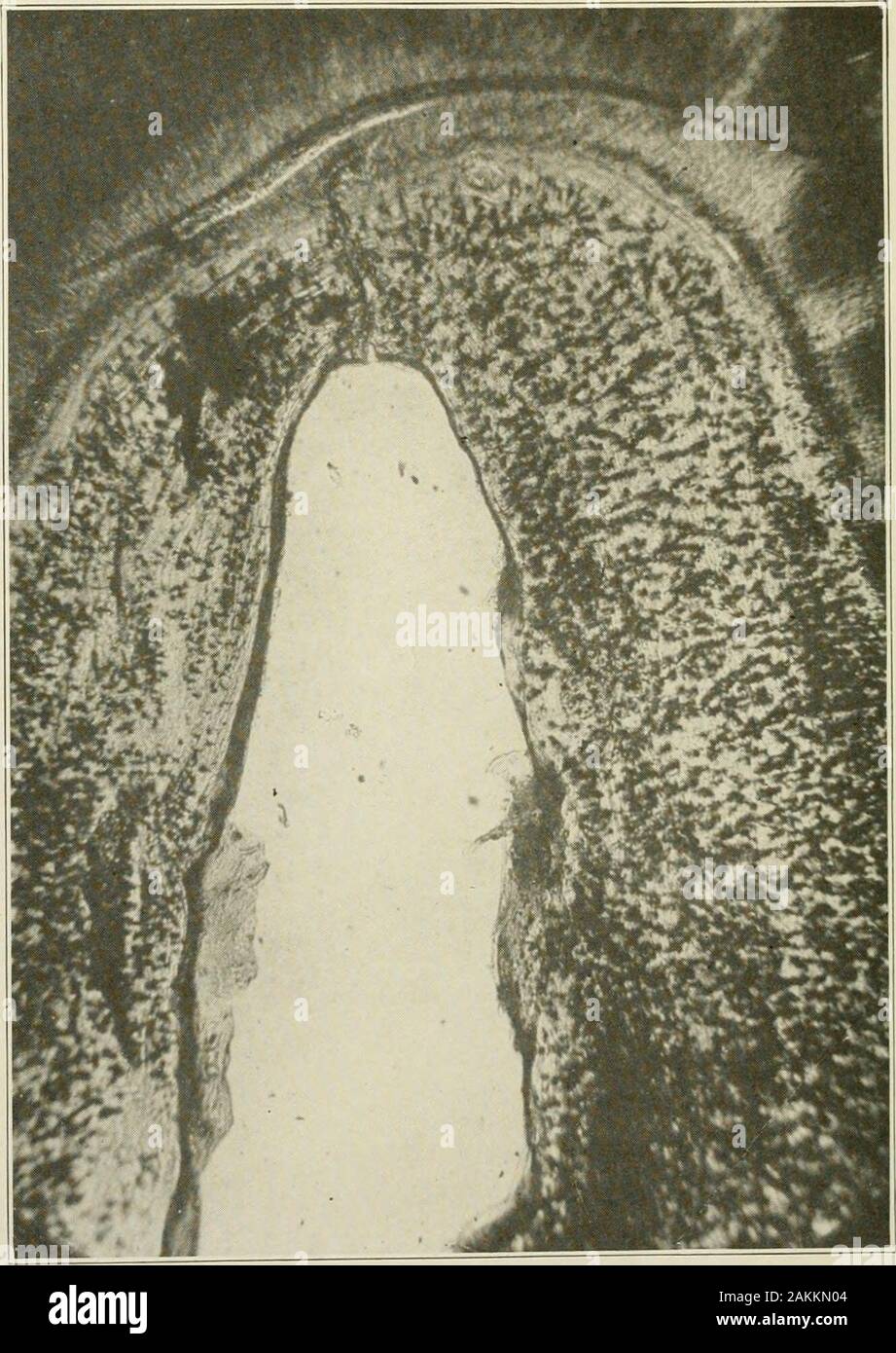 General and dental pathology with special reference to etiology and ...