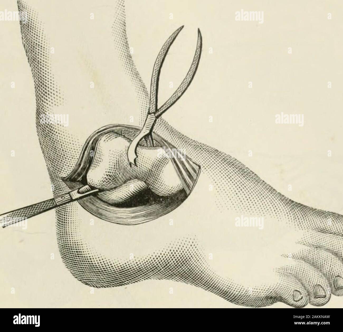 Dislocation theory hi-res stock photography and images - Alamy