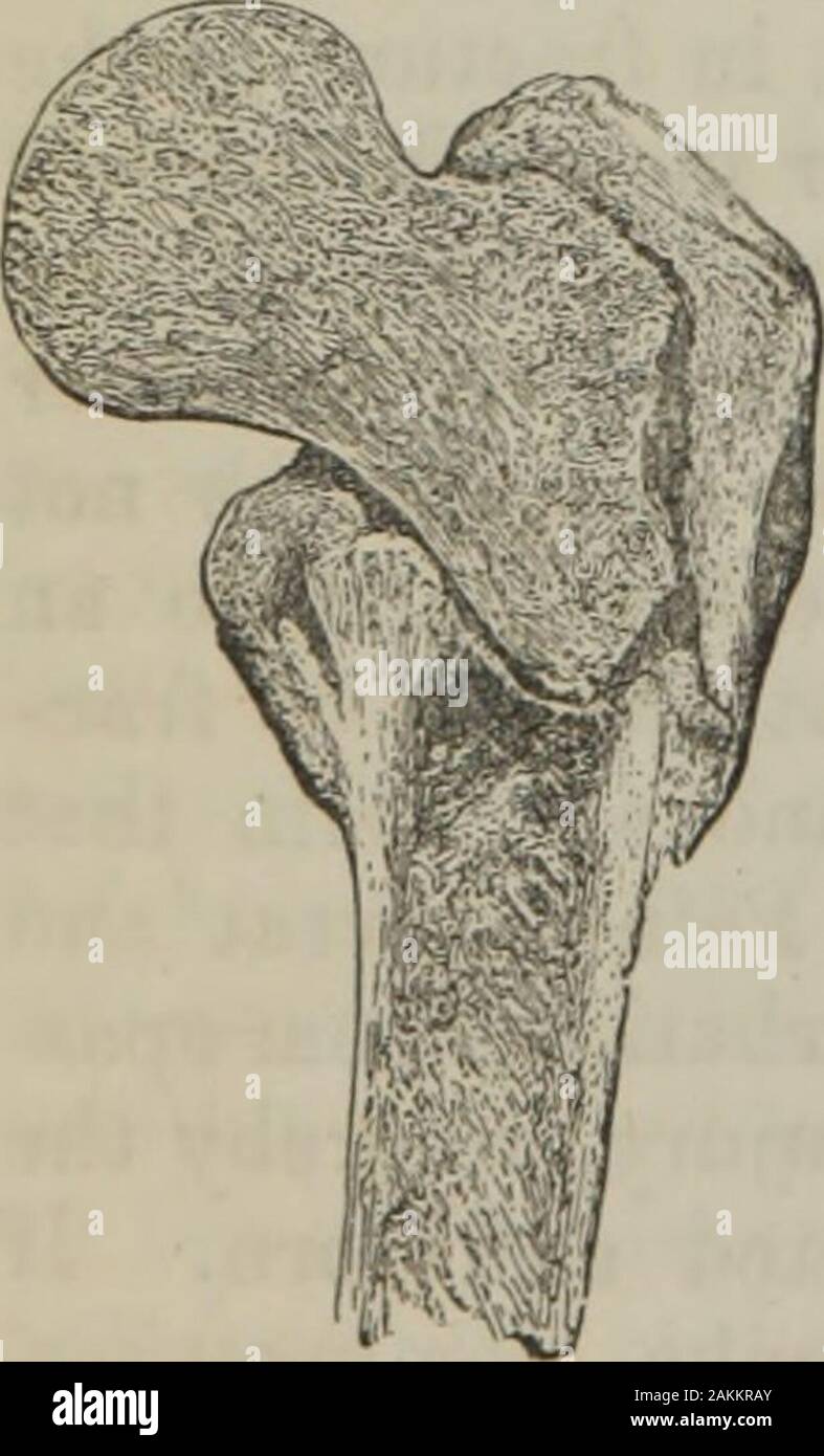 The principles of surgery . been restored, crepitus will beproduced by ...