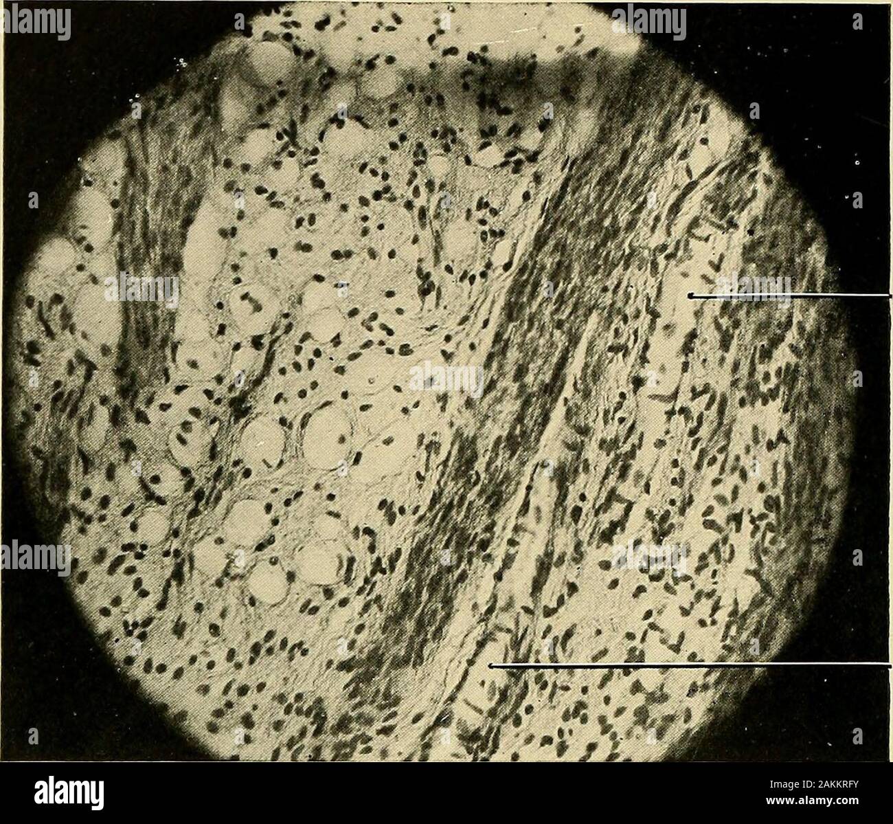 Principles and practice of operative dentistry . Fig. 639.—Human pulp ...