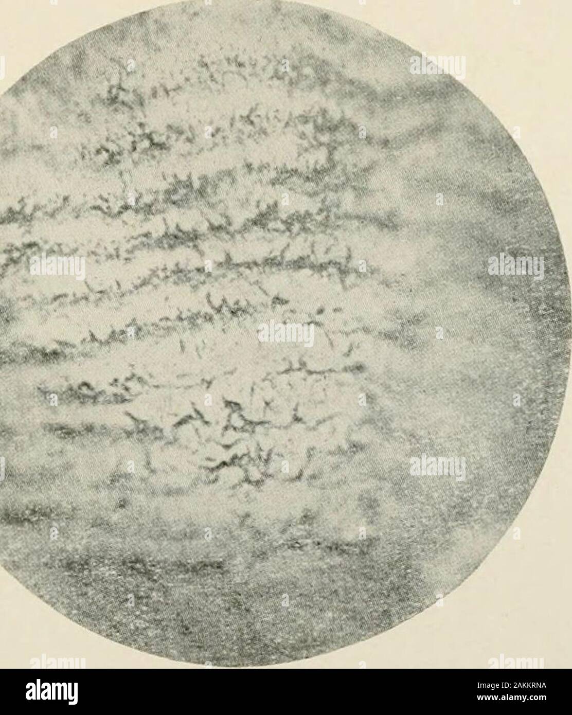 General and dental pathology with special reference to etiology and ...