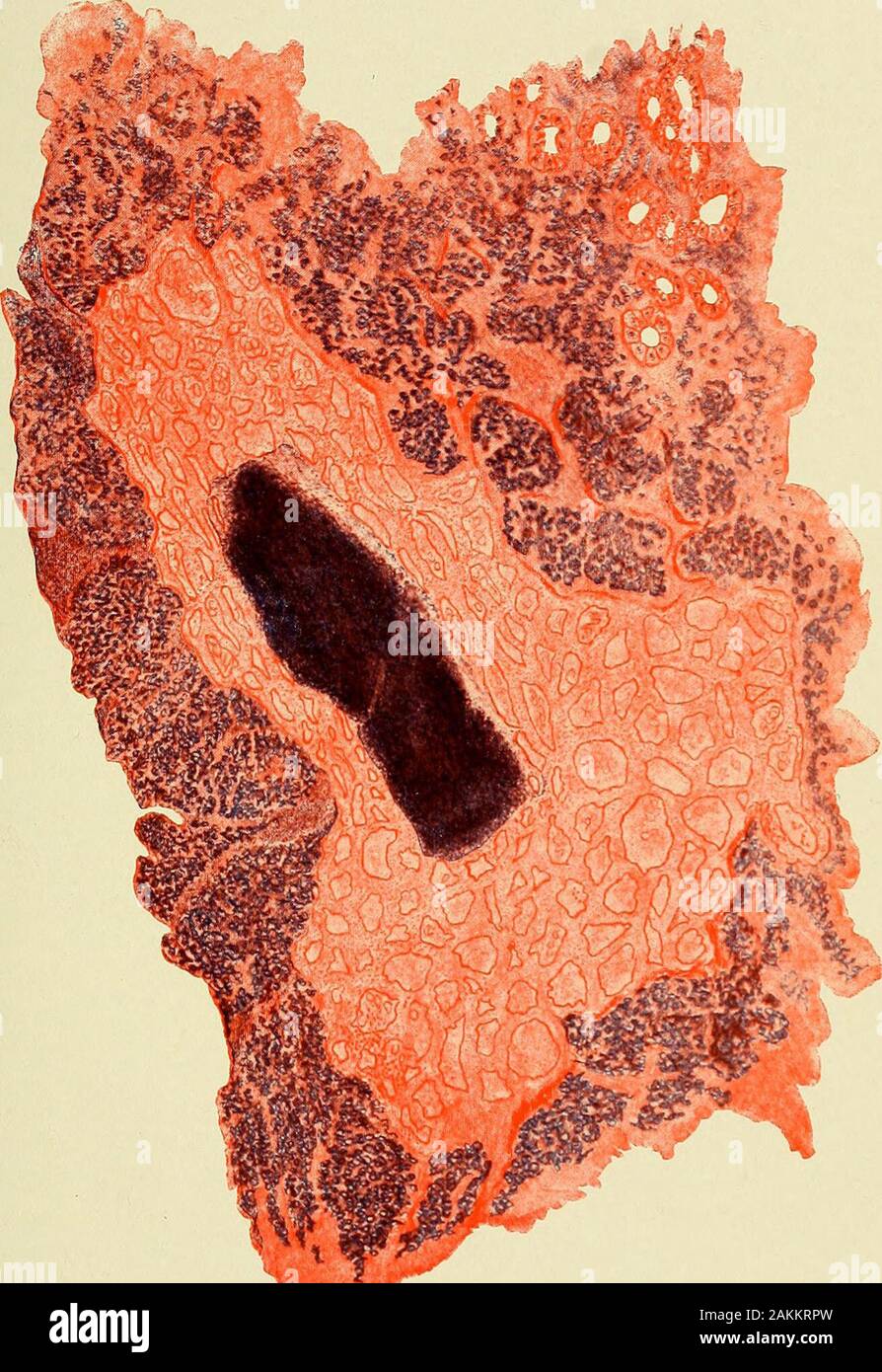 A manual of modern surgery : an exposition of the accepted doctrines ...