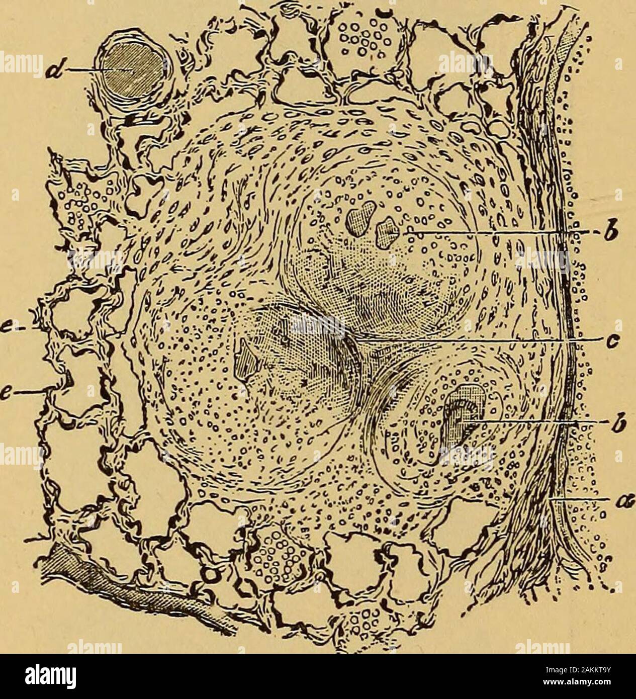 Pulmonary consumption, pneumonia, and allied diseases of the lungs ...