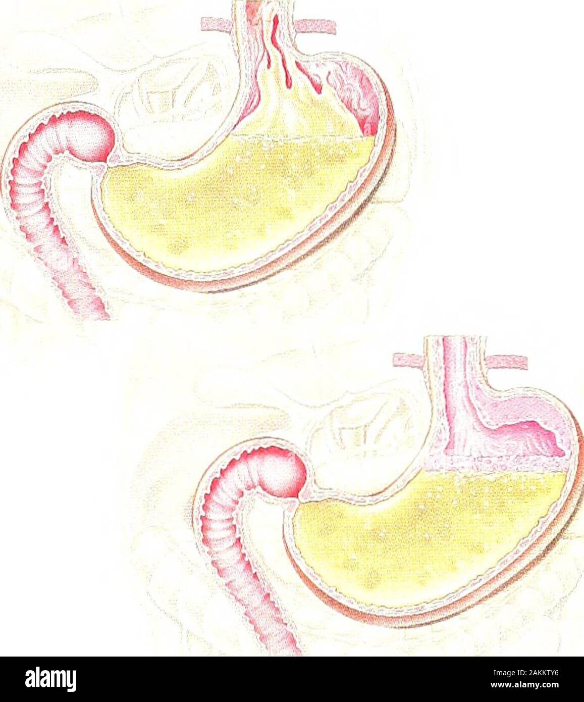 Gaviscon hi-res stock photography and images - Alamy