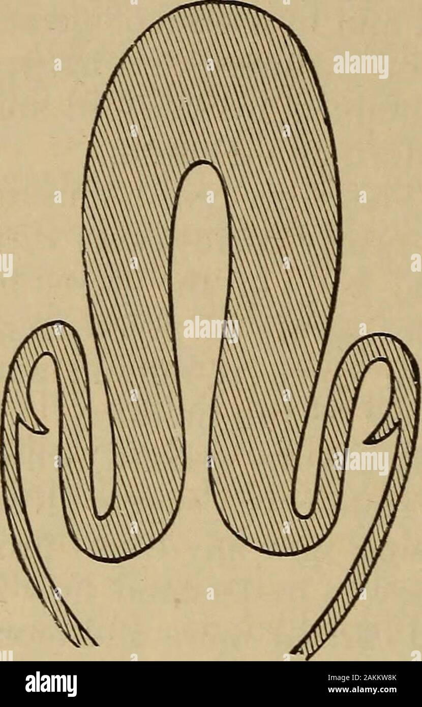 Cervix diagram hi-res stock photography and images - Alamy
