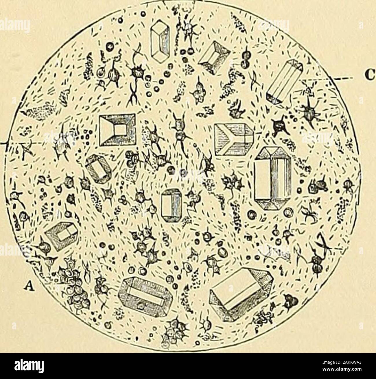 Urinary bladder catheter hi-res stock photography and images - Alamy