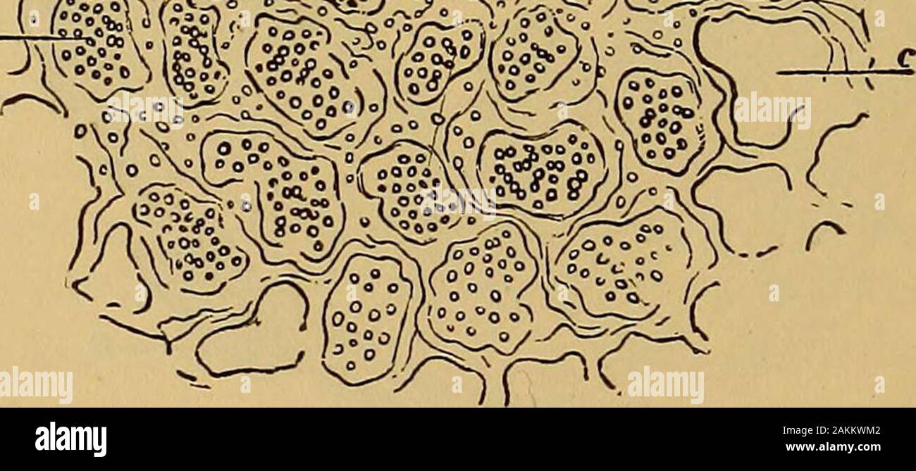Pulmonary consumption, pneumonia, and allied diseases of the lungs ...
