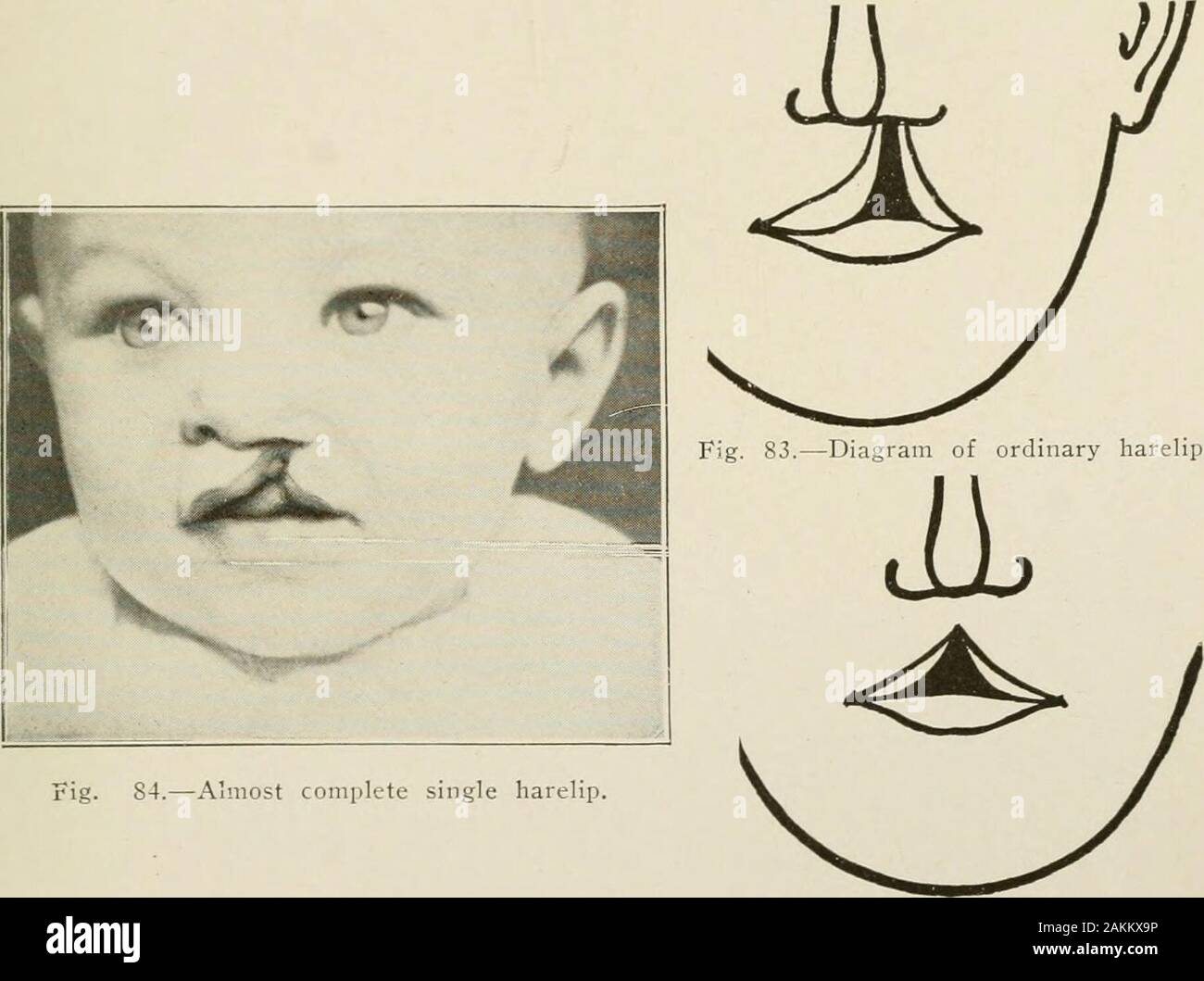 General and dental pathology with special reference to etiology and ...