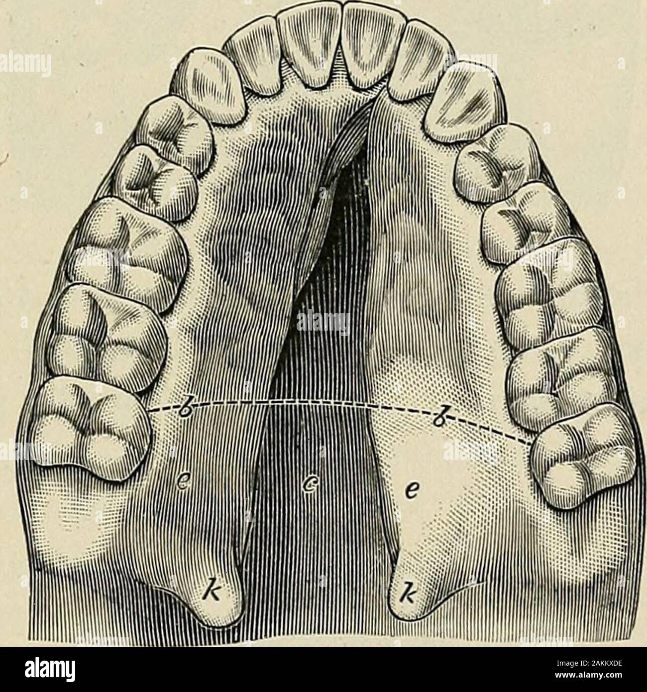 A practical treatise on mechanical dentistry . ward the outside. The ...