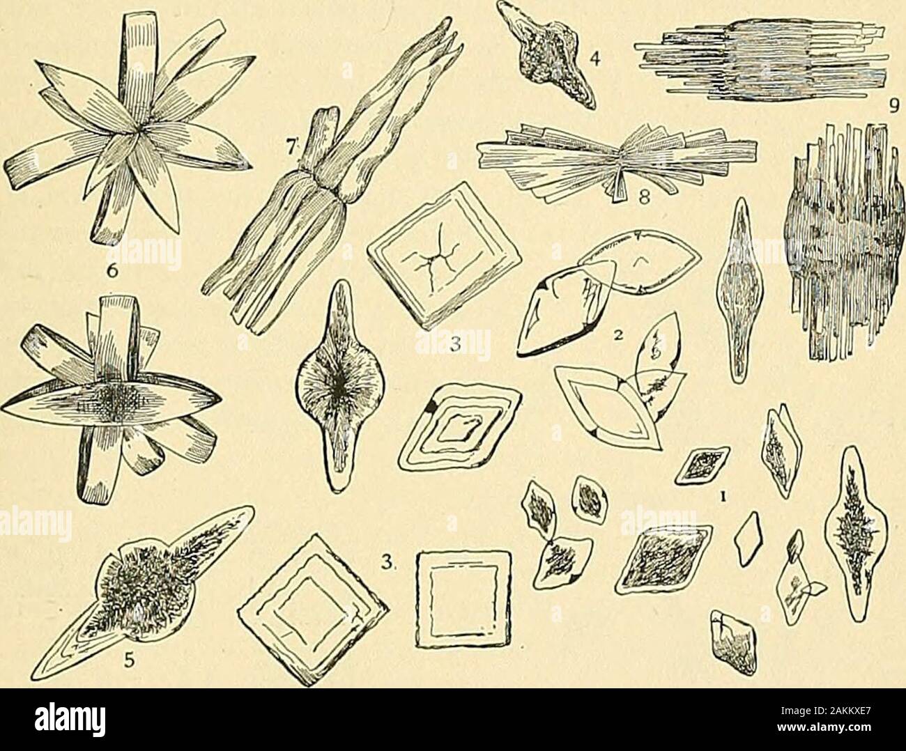 Sodium Urate In Urine