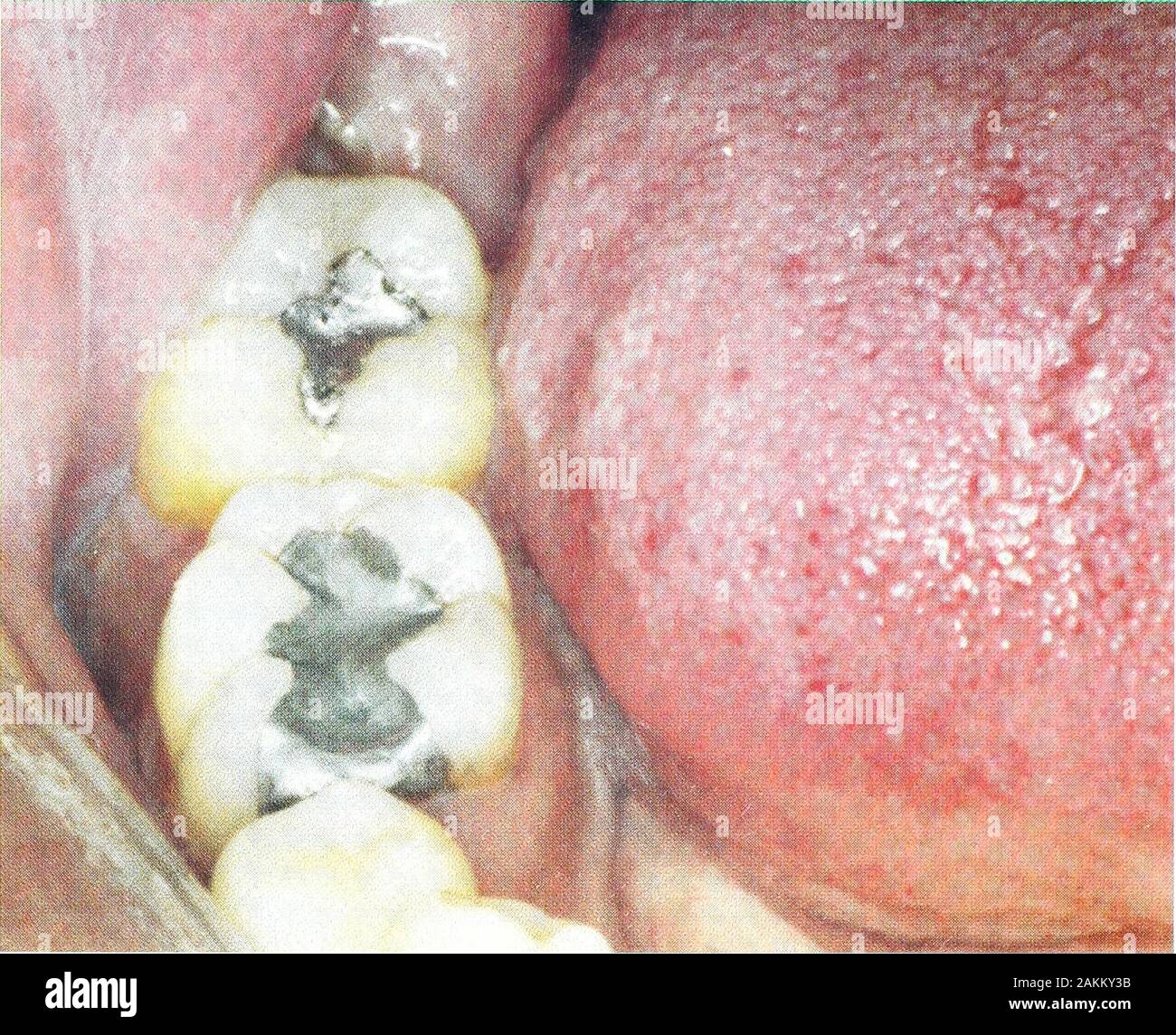 Bear a grudge hi-res stock photography and images - Alamy