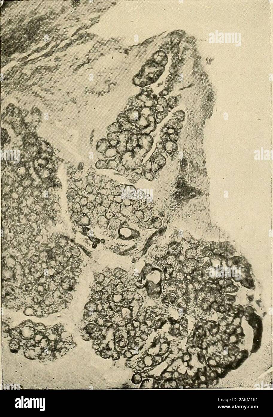 Principles and practice of operative dentistry . Fig. 618.—Salivary ...