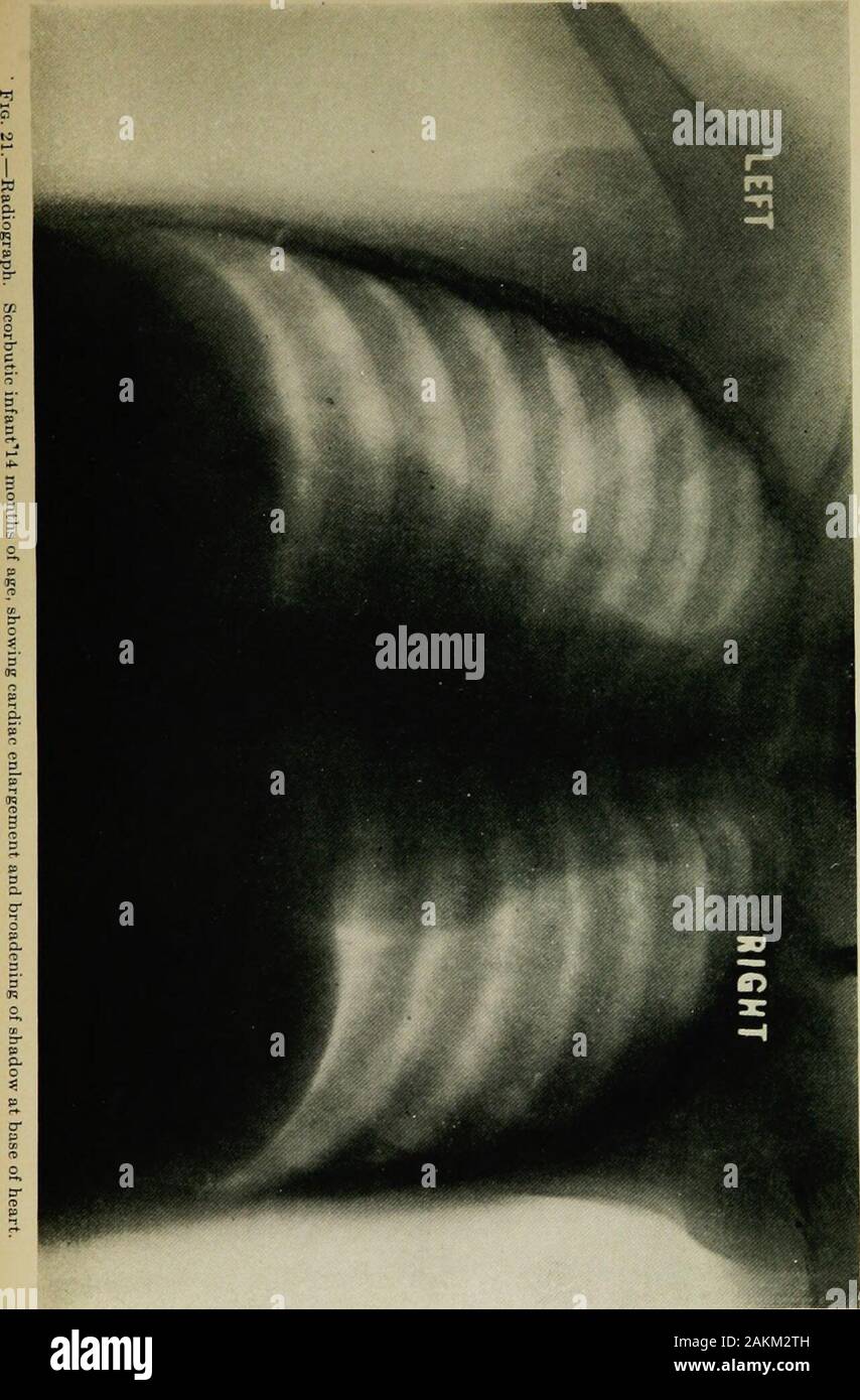 Necropsies hi-res stock photography and images - Alamy
