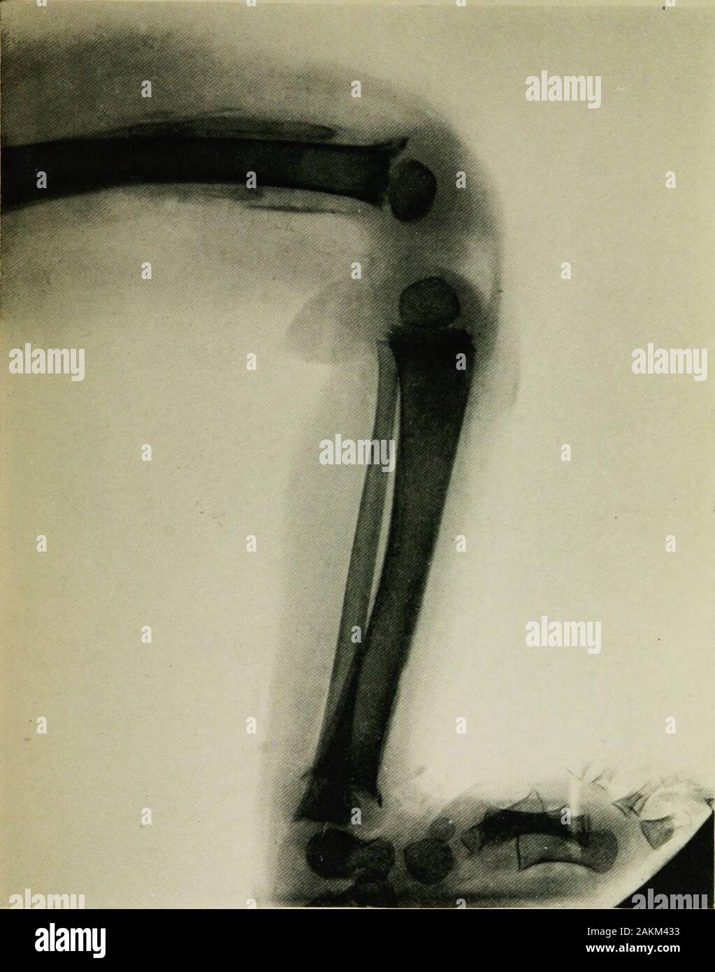 Scurvy past and present . cation, especially near thesite of the ...