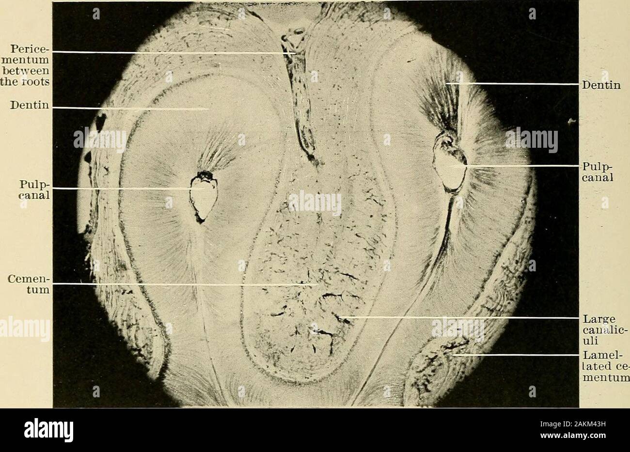 Principles and practice of operative dentistry . Fig. 605.—Vertical ...