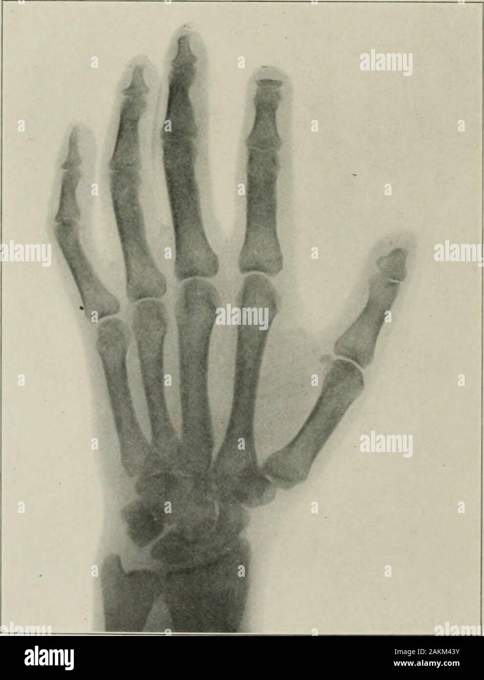 American practice of surgery : a complete system of the science and art ...