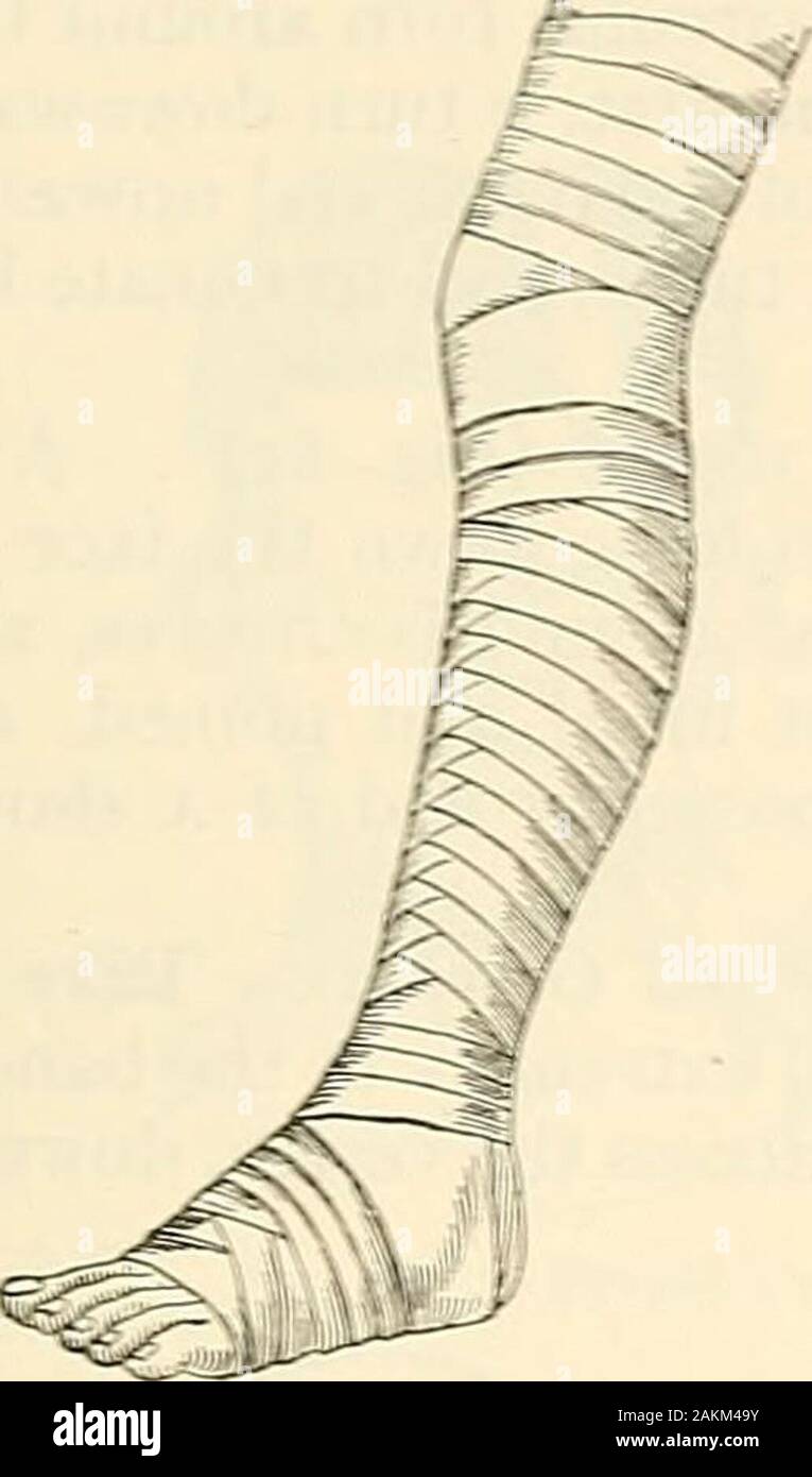 Spiral bandage hi-res stock photography and images - Alamy