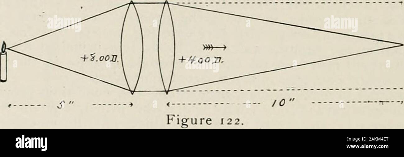 Ocular refraction and the shadow test . ated justinside of the ...