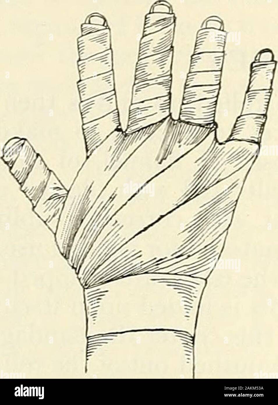 Modern surgery, general and operative . 1254 Bandages spiral reversed ...
