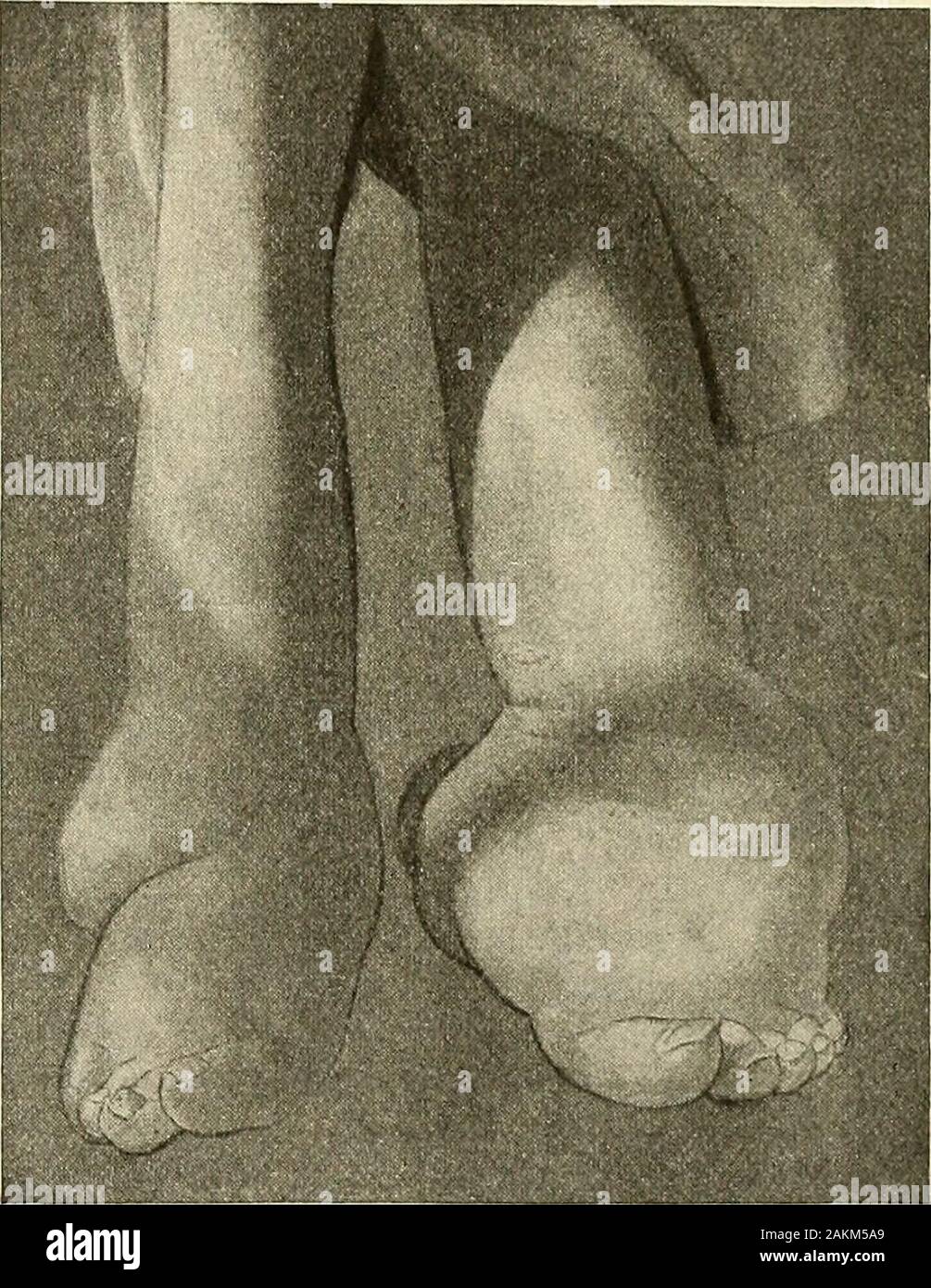 Modern surgery, general and operative . culosis is thedisease. Some few ...