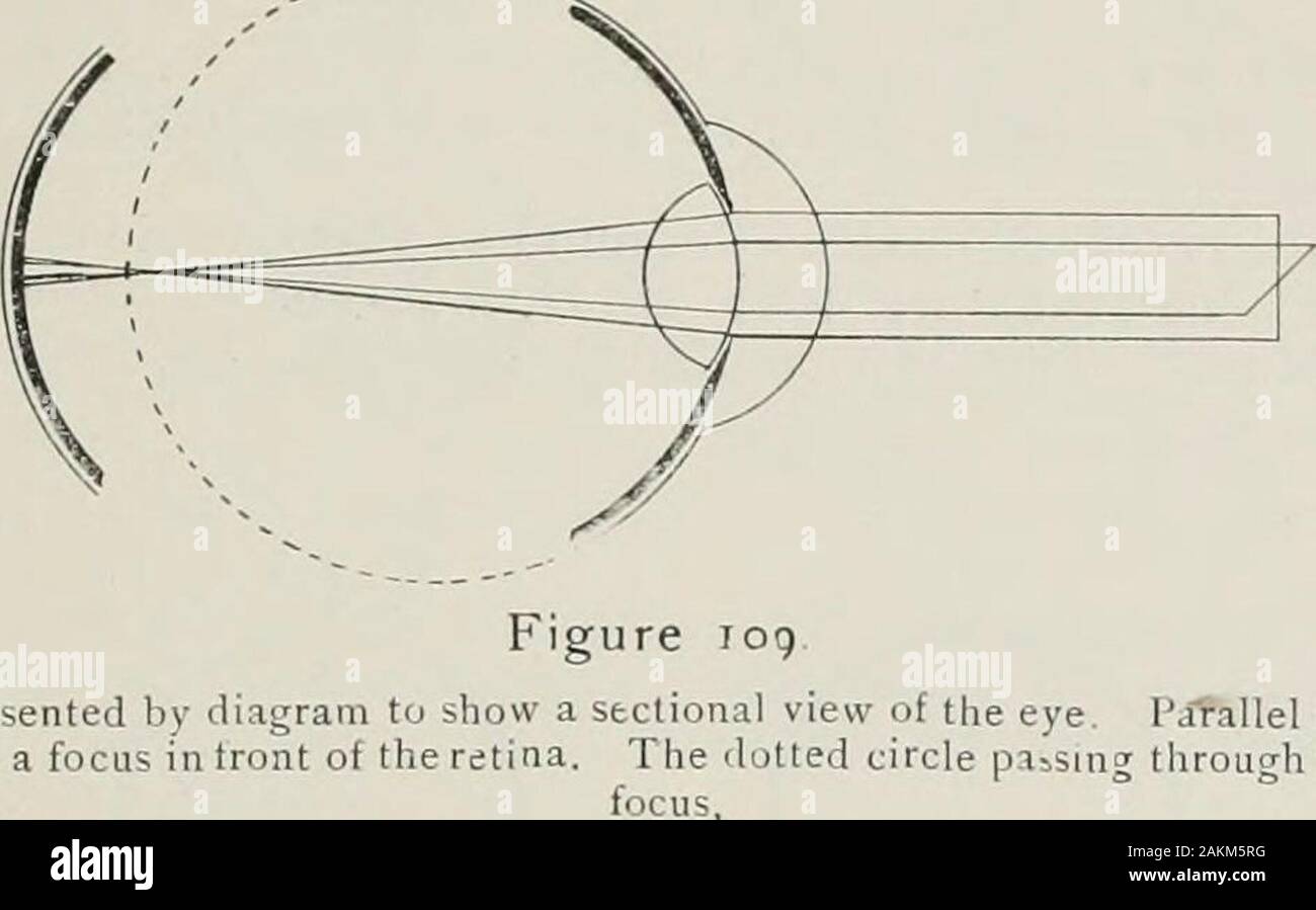 Lacking definition hi-res stock photography and images - Alamy